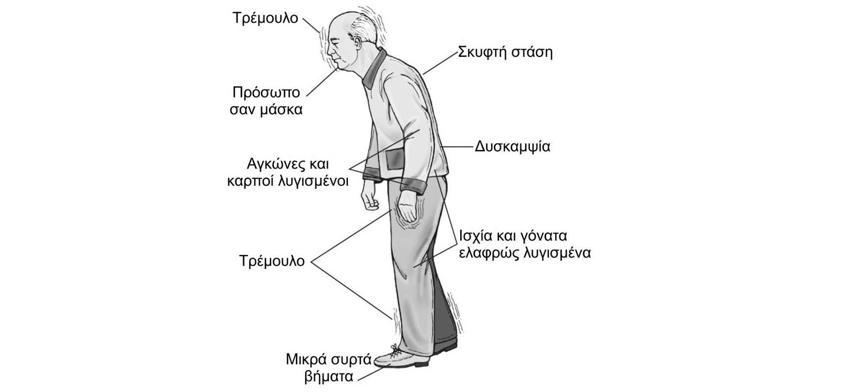 Παθήσεις - ΠΡΟΗΓΜΕΝΗ ΦΥΣΙΚΟΘΕΡΑΠΕΙΑ ΜΑΥΡΟΠΑΝΟΣ